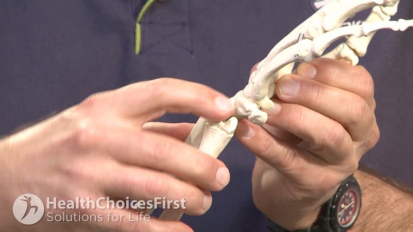 What is Clicking Wrist in Relation to Squash Injuries | Health Choices ...