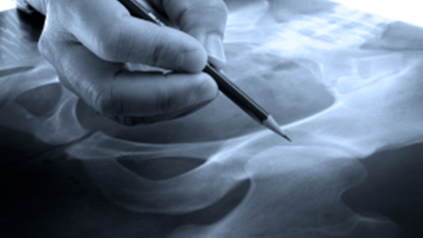 Cement vs. Cementless Hip Bone Fixation | Health Choices First