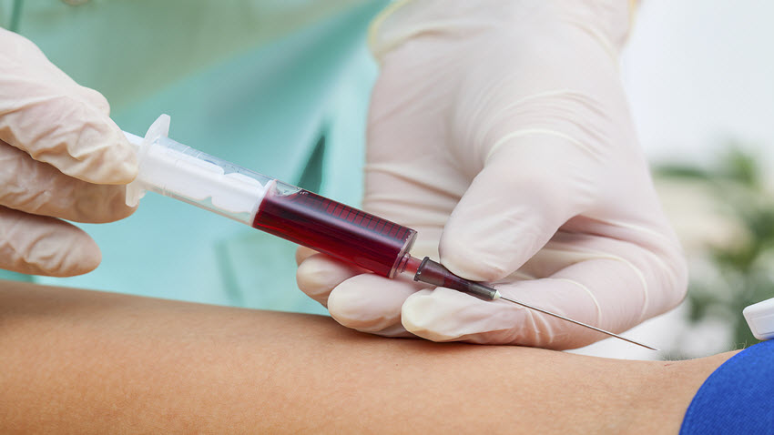 Blood Injection Diagram