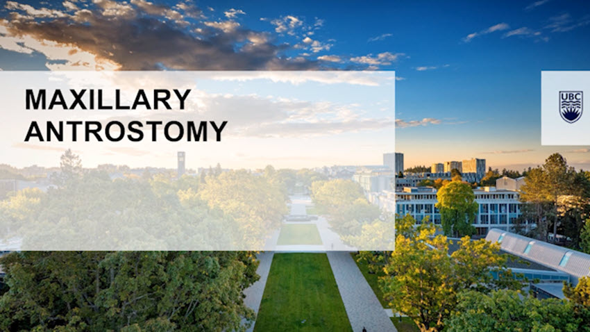 Maxillary Antrostomy - Surgical Teaching Video | Health Choices First