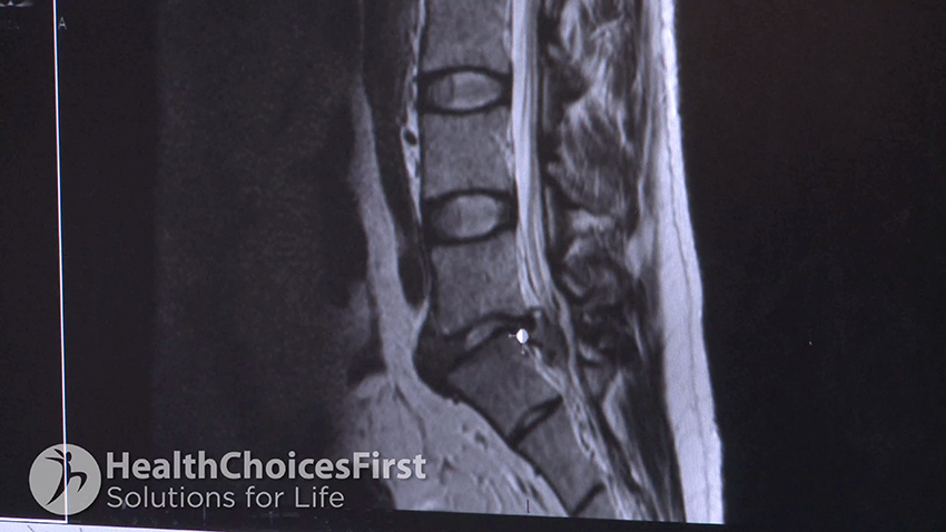 MRI Scans for Lumbar Spine Injuries and Pain Related Conditions ...