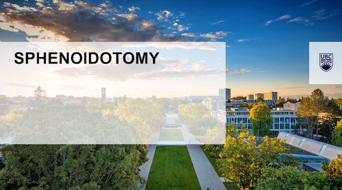 Sphenoidotomy - Surgical Teaching Video | Health Choices First